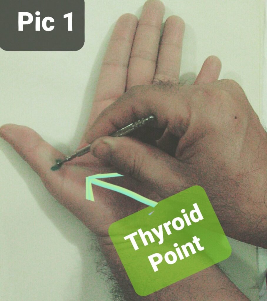 Hyperthyroidism - Monisha Mantra